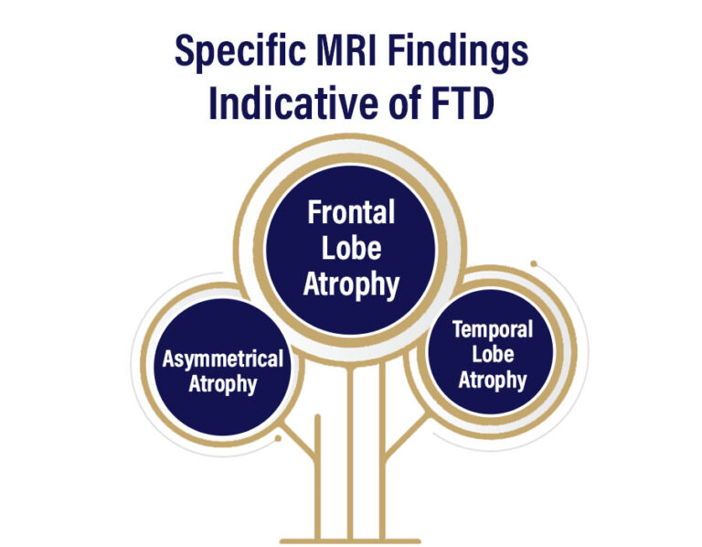 Advanced MRI Techniques for Detecting Frontotemporal Dementia